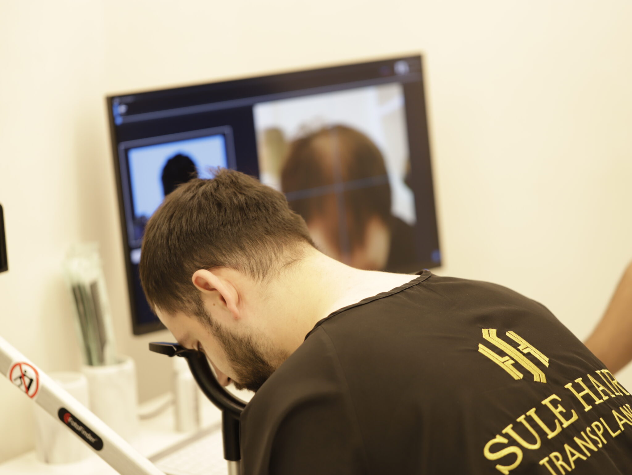 Trichoscopy Hair Transplant Planning and Simulation