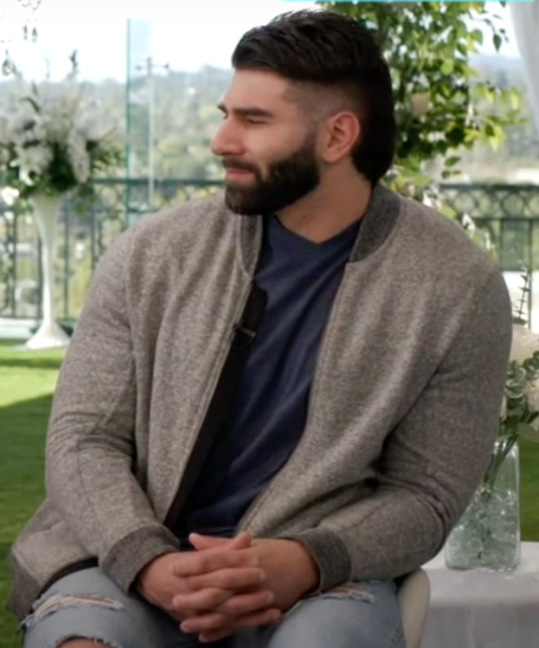 Did Trevor Love is Blind have a hair transplant? - SULE HAIR TRANSPLANT