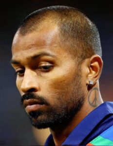 Hardik Pandya Hair Transplant - SULE HAIR TRANSPLANT