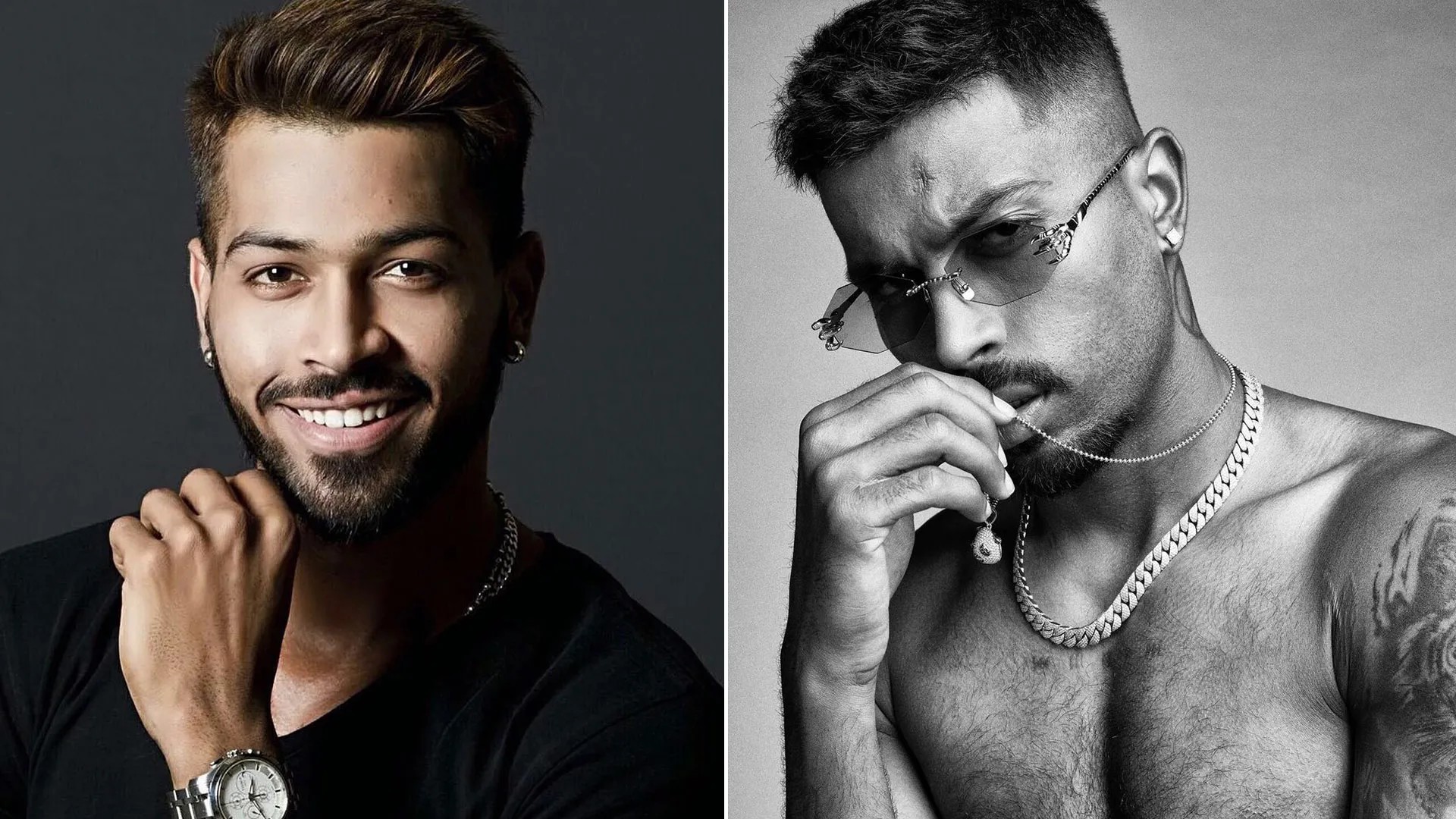 Hardik Pandya Hair Transplant - SULE HAIR TRANSPLANT