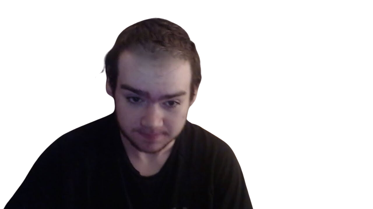 Mongraal's Hairline: A Deep Dive into His Hair Analysis - SULE HAIR ...