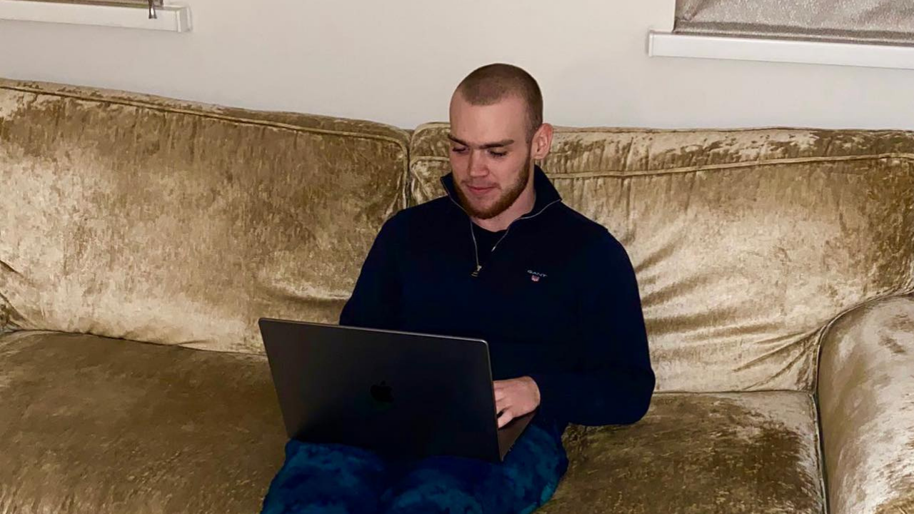 Mongraal's Hairline: A Deep Dive into His Hair Analysis - SULE HAIR ...