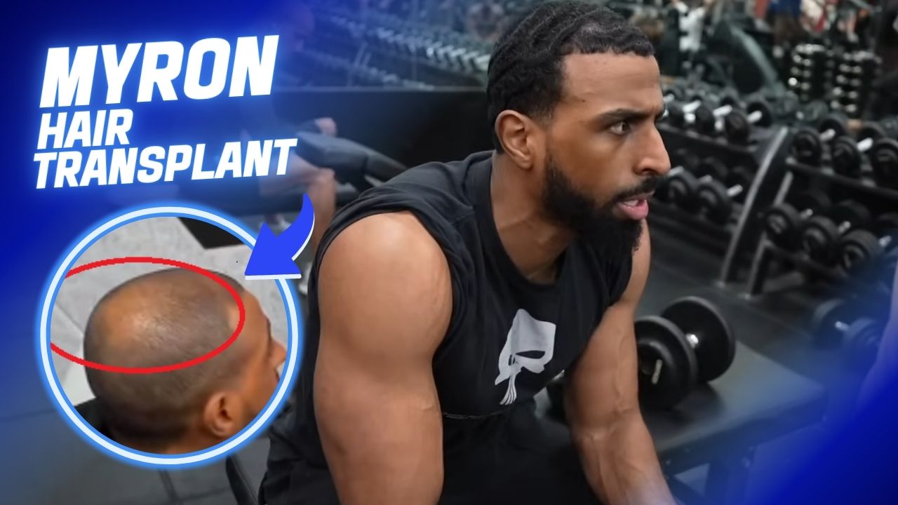 Myron Hair Transplant - SULE HAIR TRANSPLANT