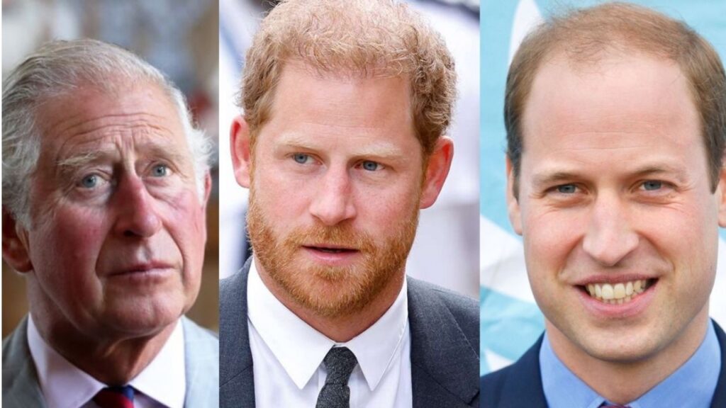 Prince Harry Hair Transplant: An Overview of Prince’s Hairline - SULE ...