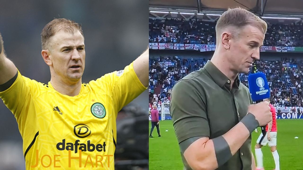 British Celebrities Hair Transplants: Real Stories and Insights