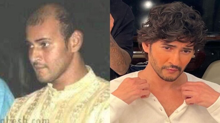 Inside Mahesh Babu’s Hair Journey: Techniques, Costs, and Expert Opinions - SULE HAIR TRANSPLANT